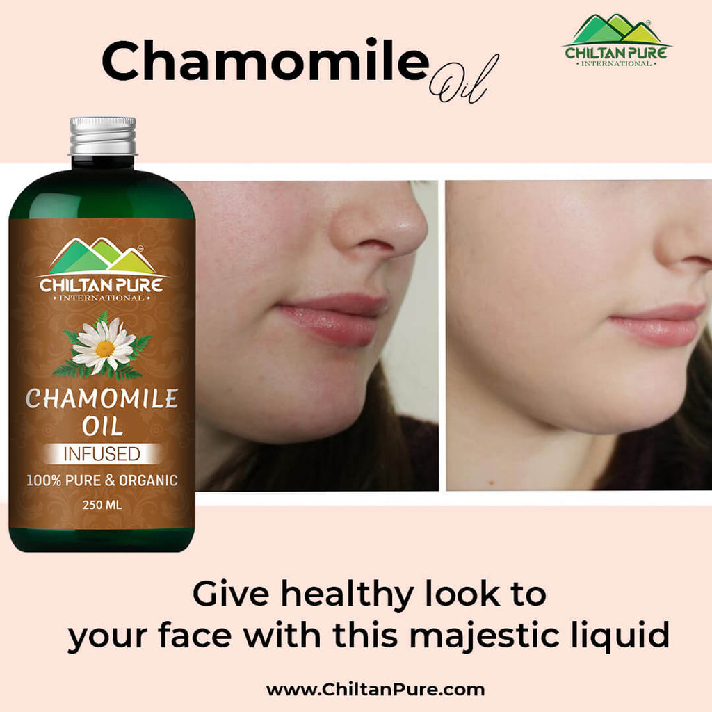 Buy Chamomile Oil at Best Price in Pakistan - ChiltanPure